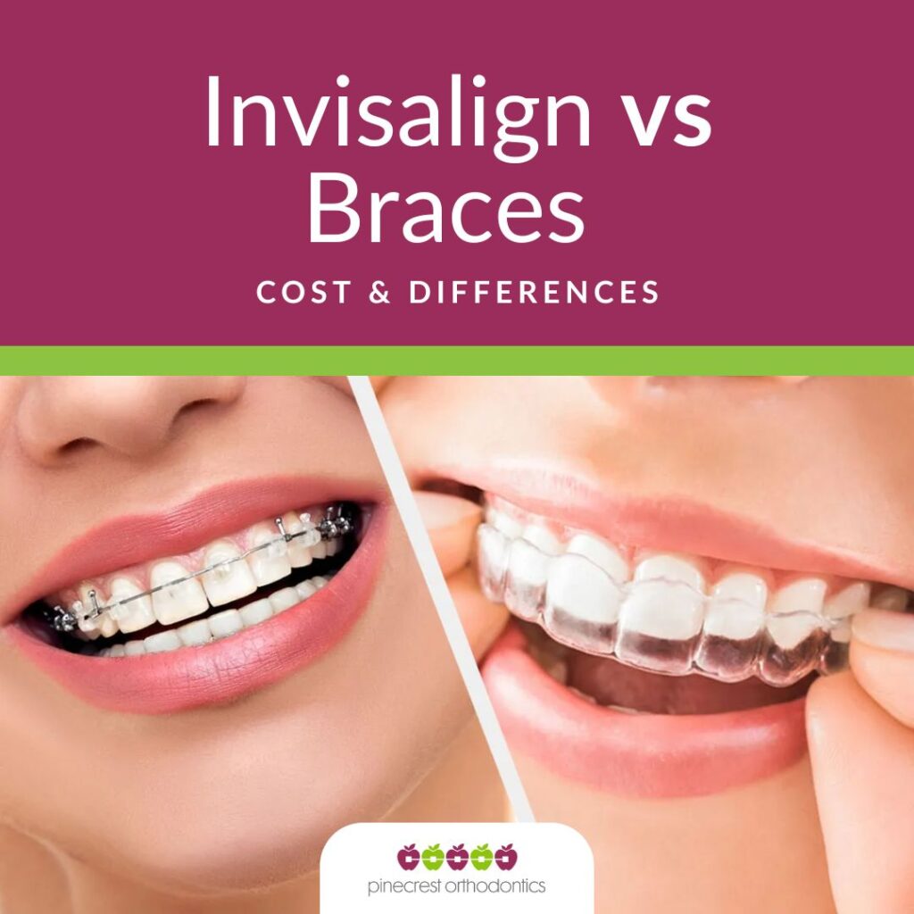 Invisalign Vs Braces Cost What You Need To Know